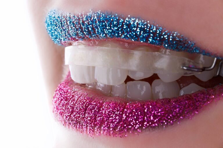 Let’s get things straight… - Sparklysmile Dental Blackheath